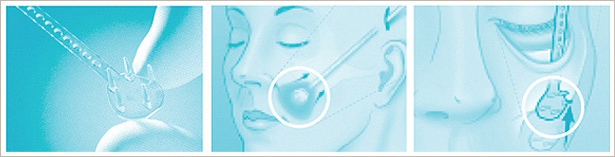 Our Services | Introduction | Plastic Surgery | Asan Medical Center